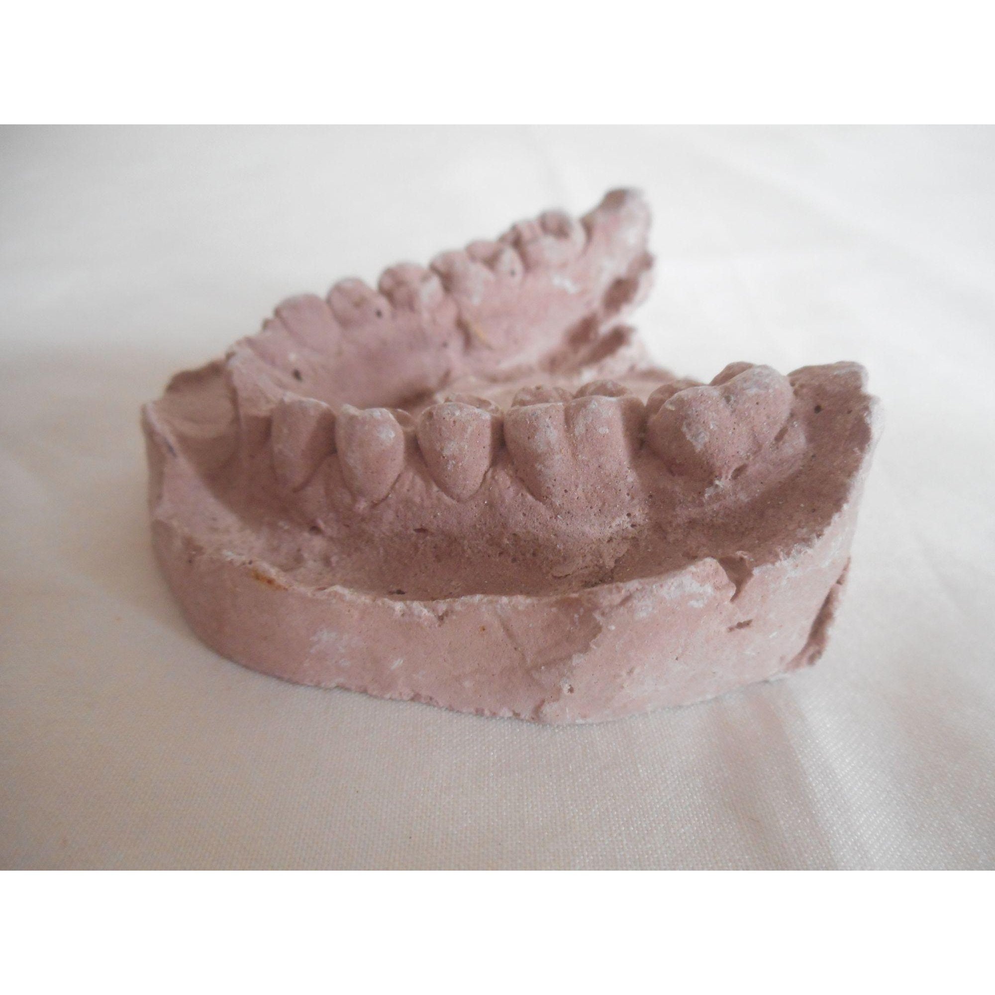 Vintage Cast Dental Teeth Mold Tooth Castings Medical Oddity #9 - Etsy