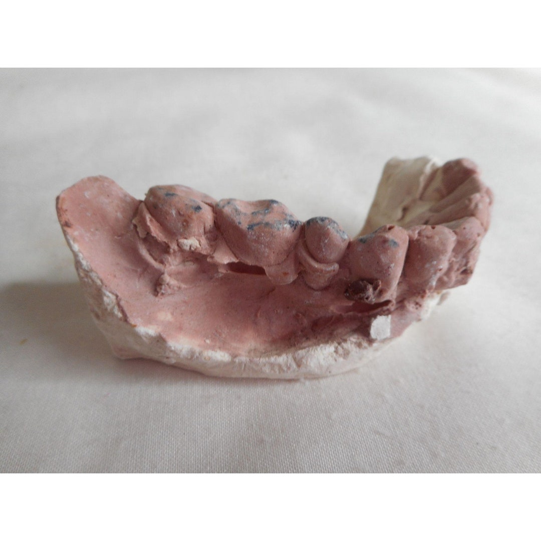 Vintage Cast Dental Teeth Mold Tooth Castings Medical Oddity #12 - Etsy