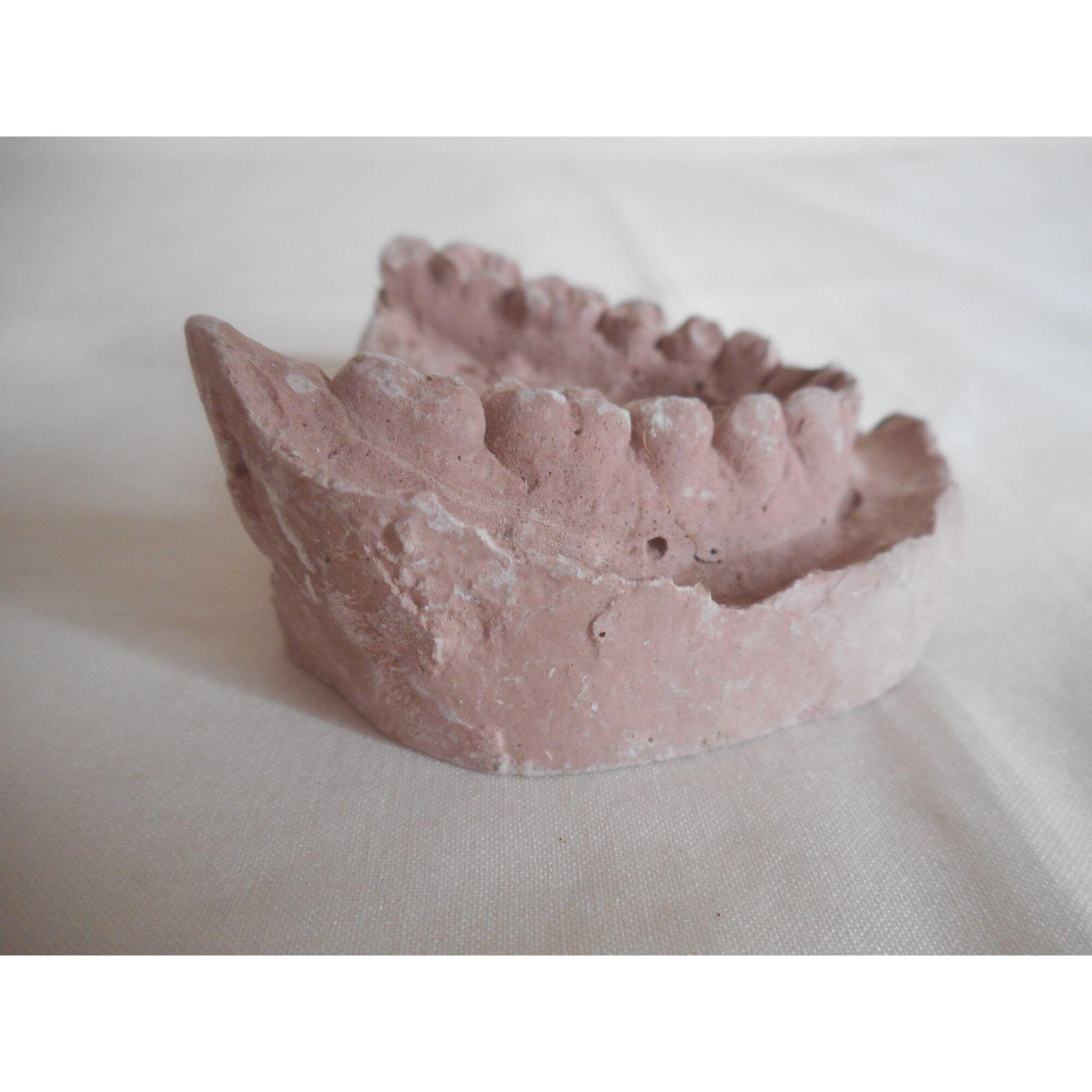 Vintage Cast Dental Teeth Mold Tooth Castings Medical Oddity #9 - Etsy