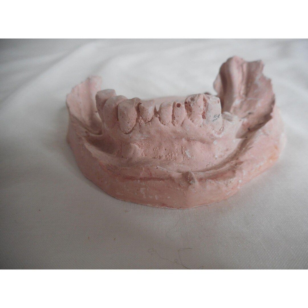 Vintage Cast Dental Teeth Mold Tooth Castings Medical Oddity #3 - Etsy