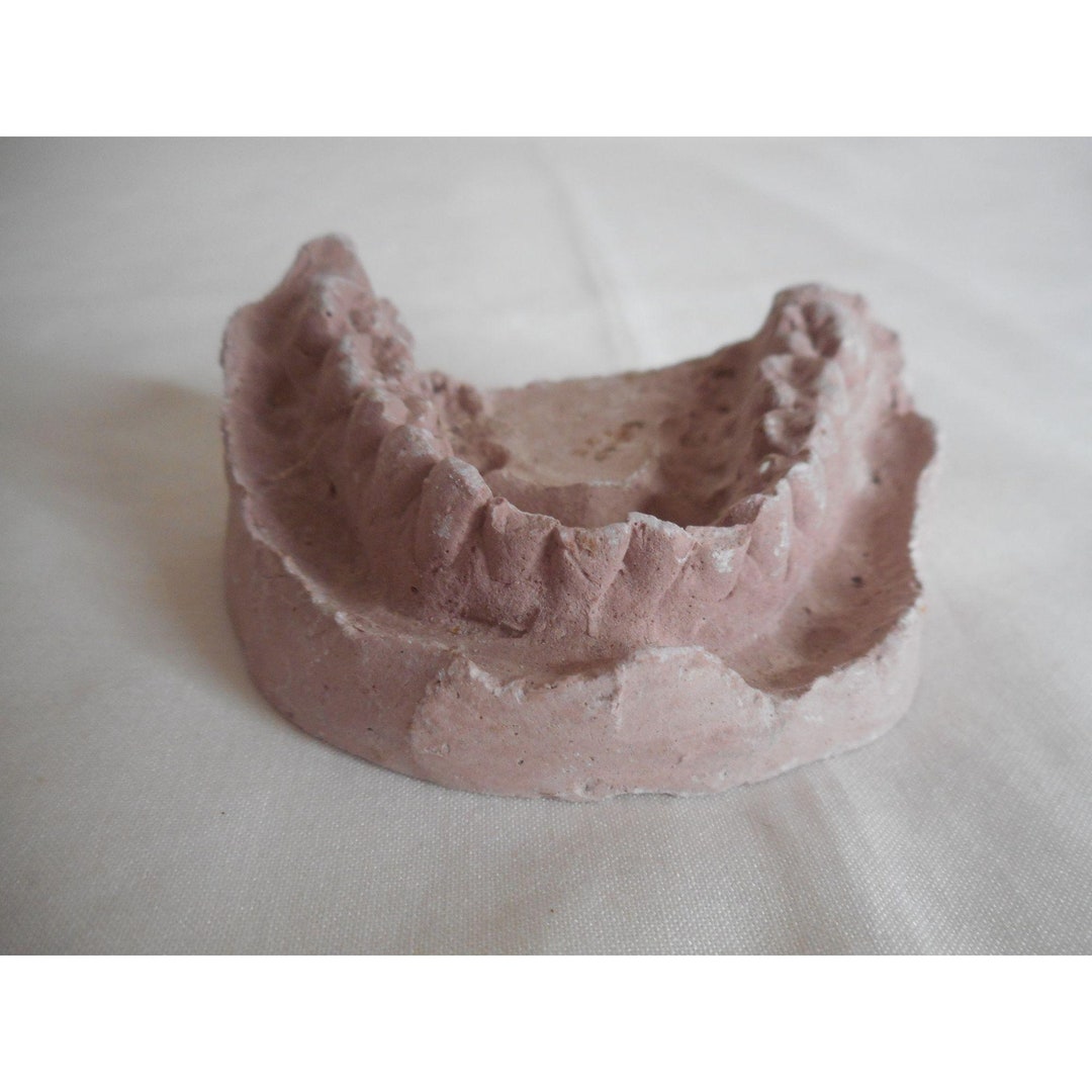Vintage Cast Dental Teeth Mold Tooth Castings Medical Oddity #9 - Etsy