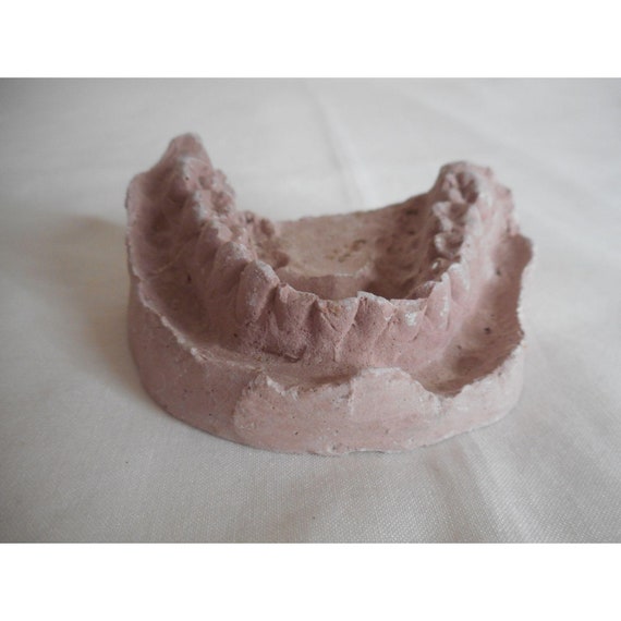 Vintage Cast Dental Teeth Mold Tooth Castings Medical Oddity | Etsy