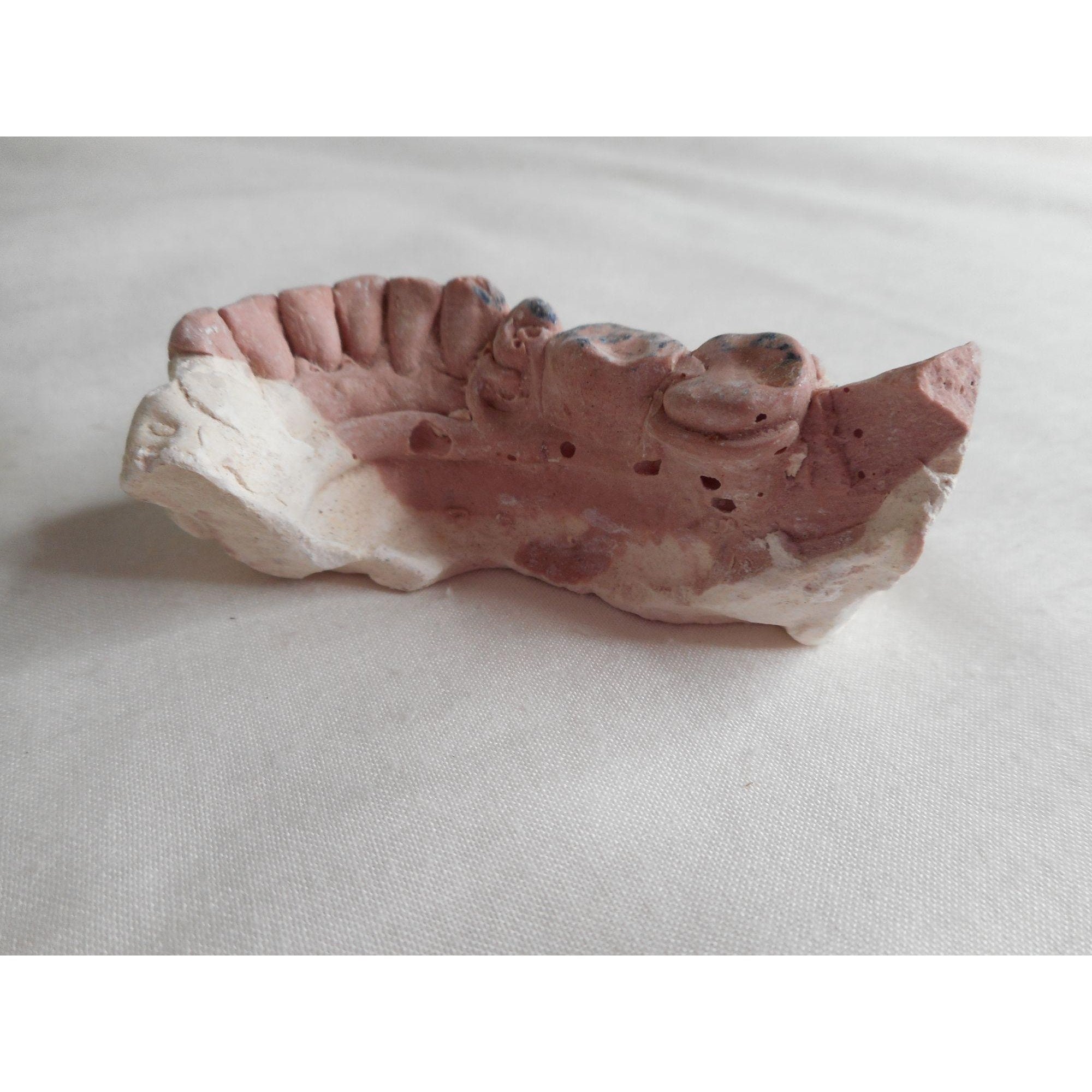 Vintage Cast Dental Teeth Mold Tooth Castings Medical Oddity #12 - Etsy