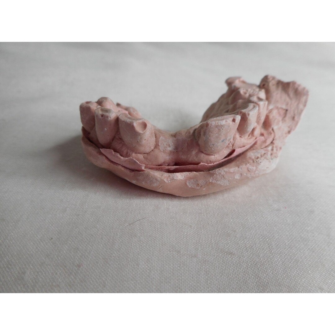 Vintage Cast Dental Teeth Mold Tooth Castings Medical Oddity #10 - Etsy