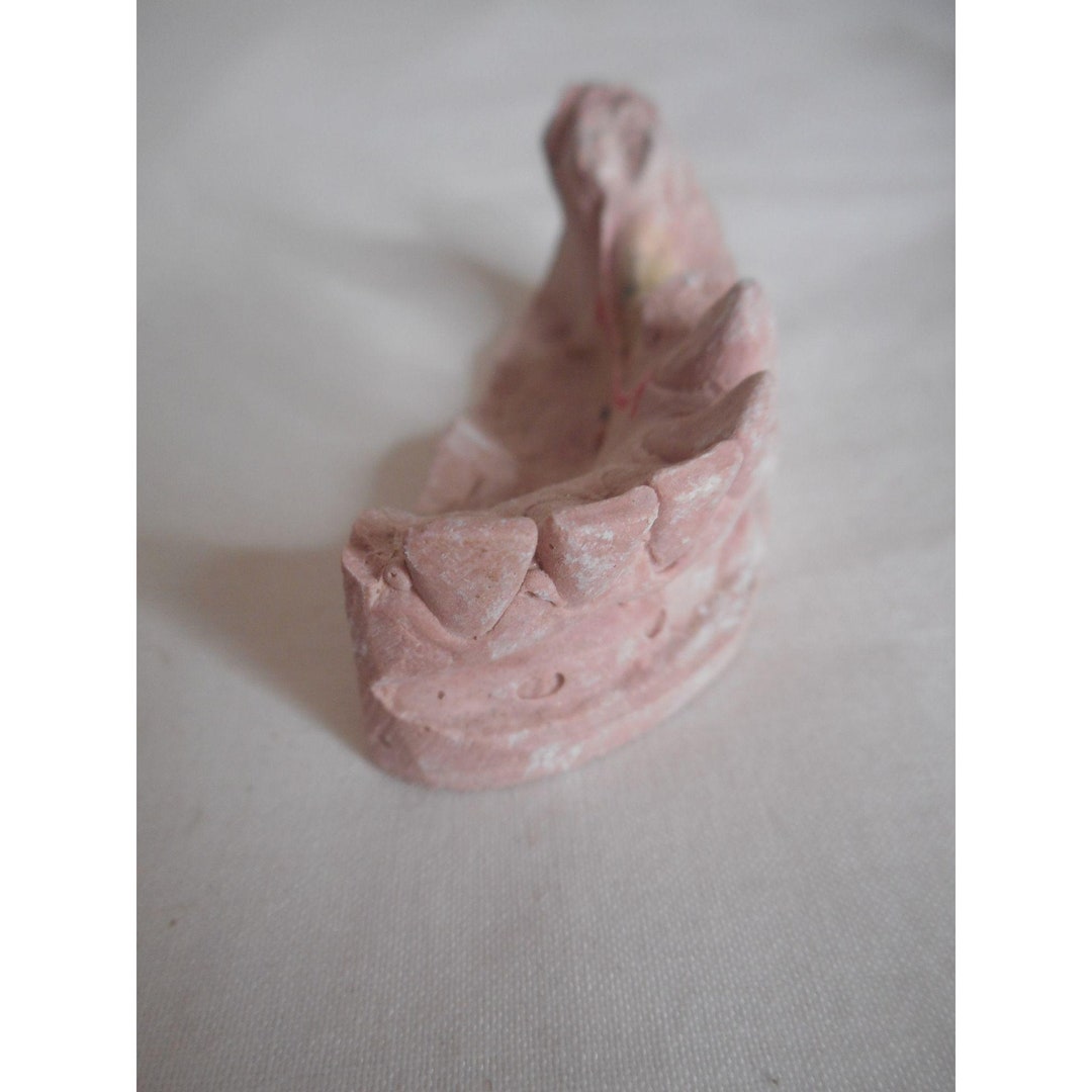 Vintage Cast Dental Teeth Mold Tooth Castings Medical Oddity #7 - Etsy