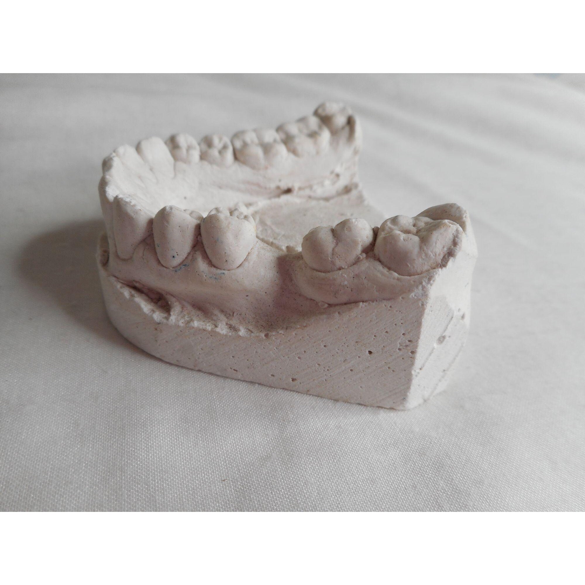 Vintage Cast Dental Teeth Mold Tooth Castings Medical Oddity 13 - Etsy