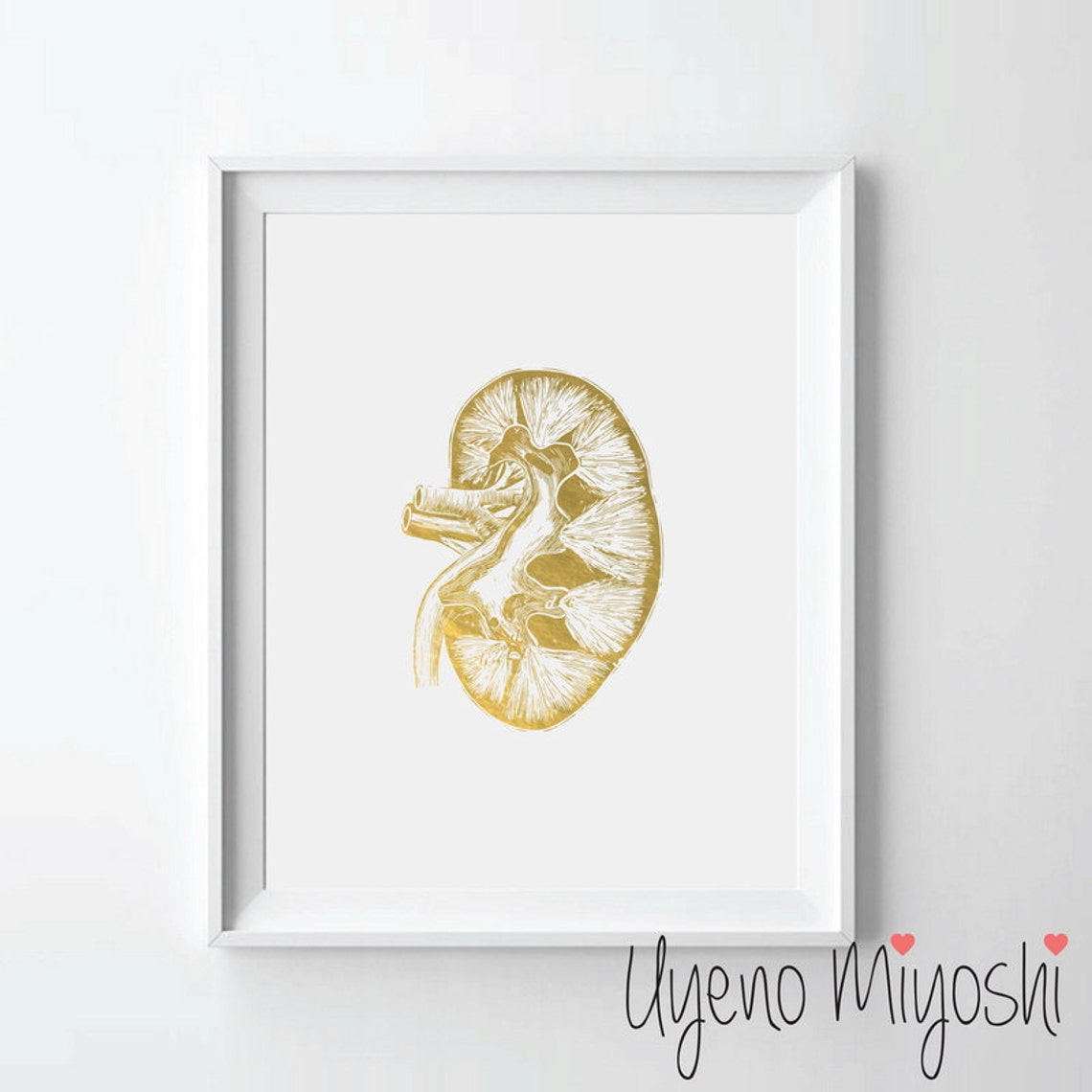 Human Kidney II Anatomy Gold Foil Print Gold Print Kidneys - Etsy