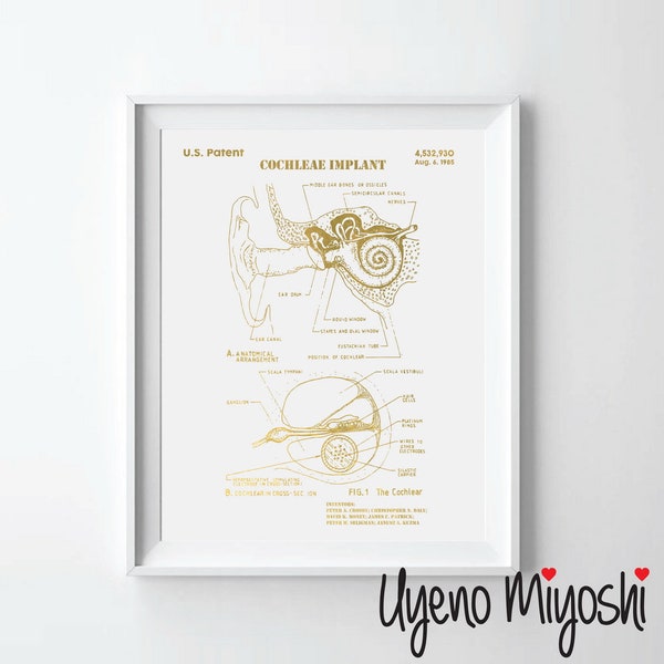 Cochlear Implant Diagram - Etsy