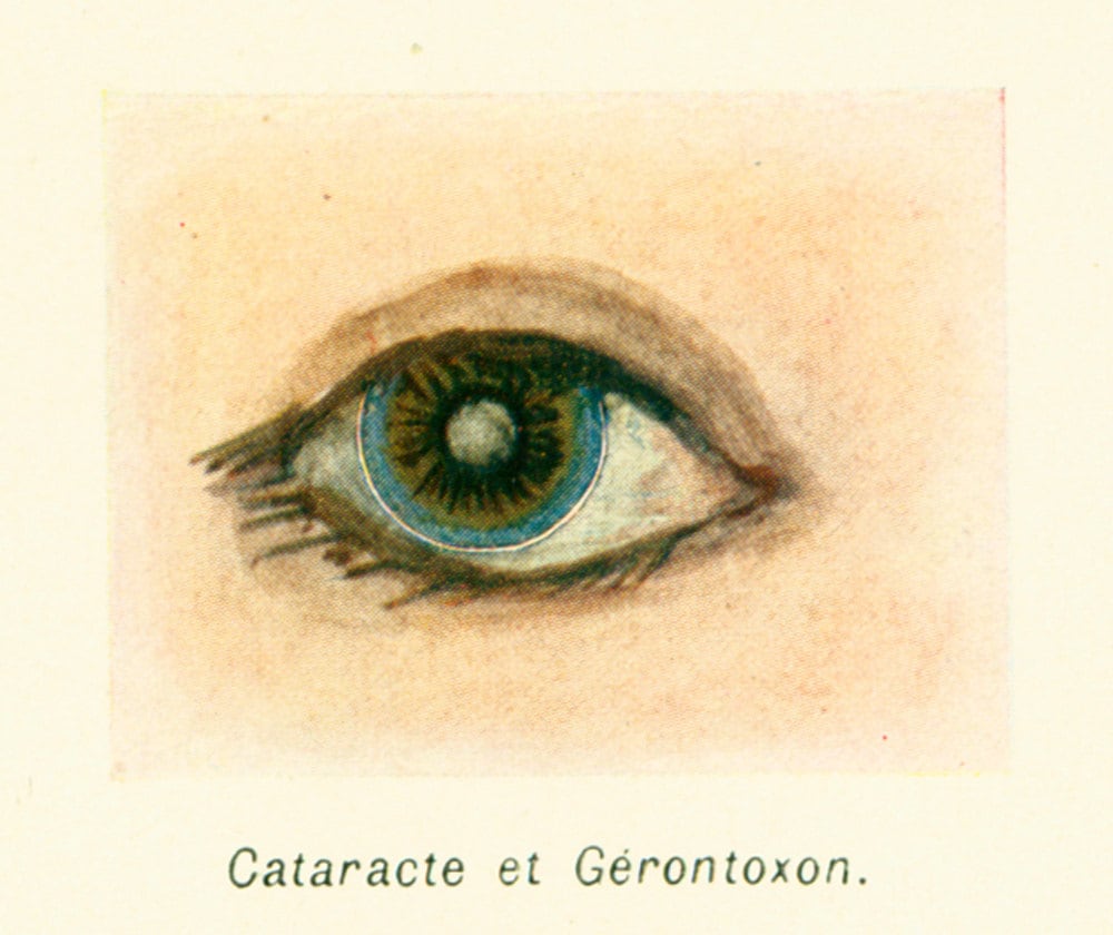 1912 Eye Anatomy Eye Disease Wall Eyes Minnow Medicine & - Etsy