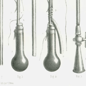 1865 Antique Obstetrical Tools Print, Pelvimeter, Midwife and ...