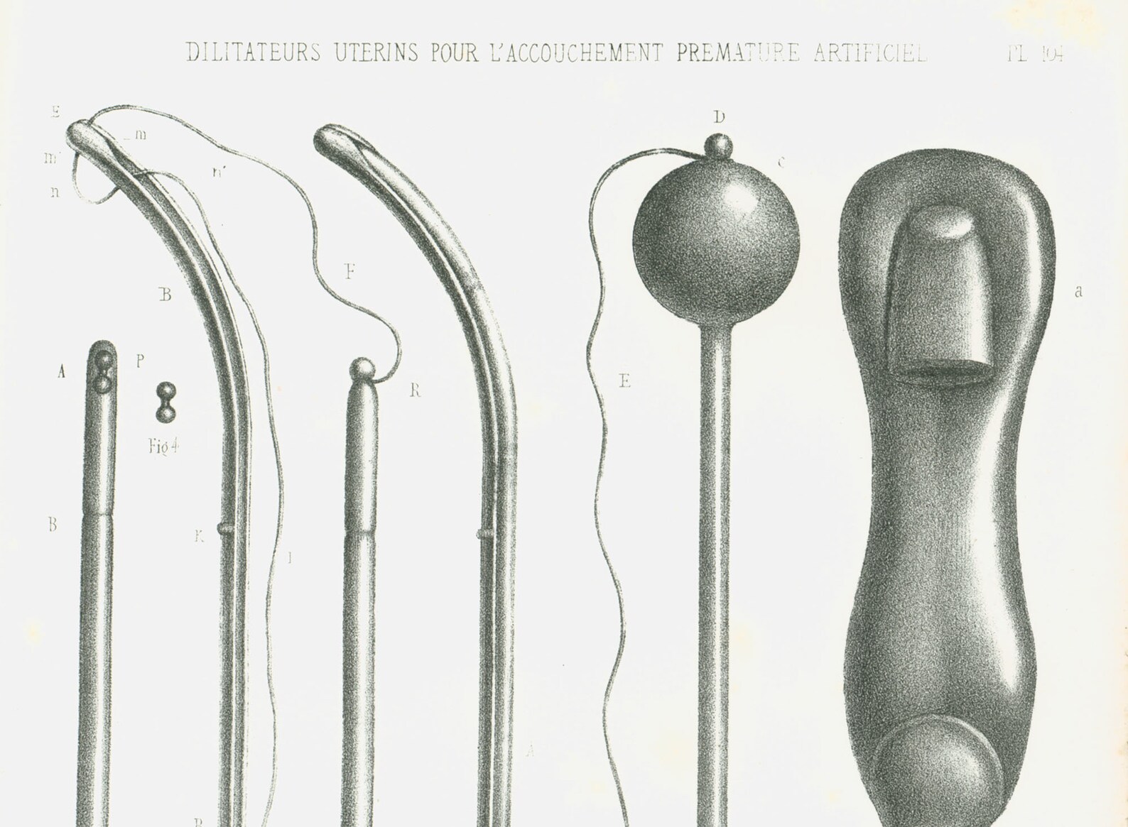1865 Antique Obstetrical Tools Print Pelvimeter Midwife and - Etsy