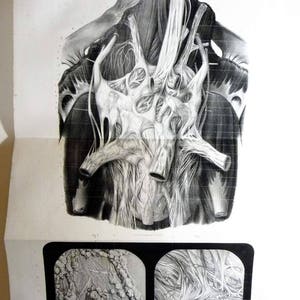 1844 Antique XL Solar Plexus Anatomy Lithograph Nervous System Human ...