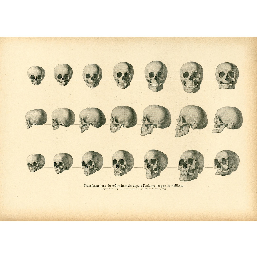 1908 Transformation of the Human Skull From Childhood to Old Age ...