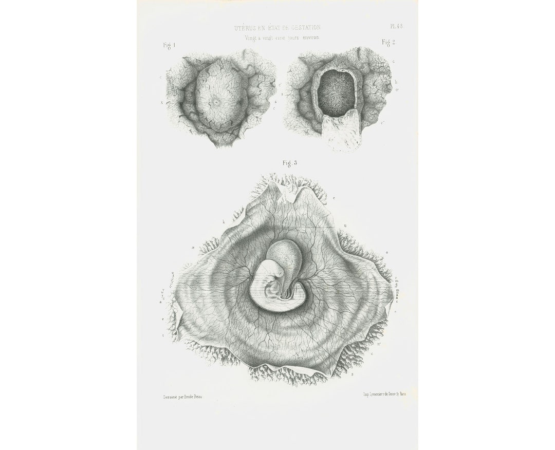 1865 Human Embryogenesis, Antique Obstetrics Print XL, Anatomy ...