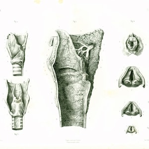 1836 Voice Box Human Larynx Print, Olfactory System, Nasal, Antique ...