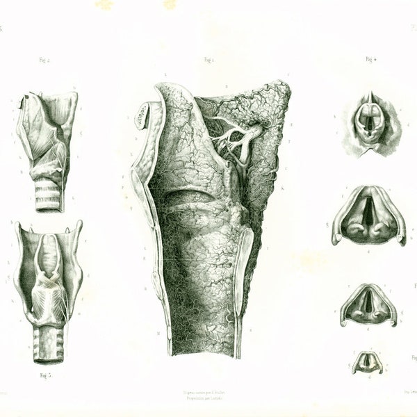 Larynx - Etsy