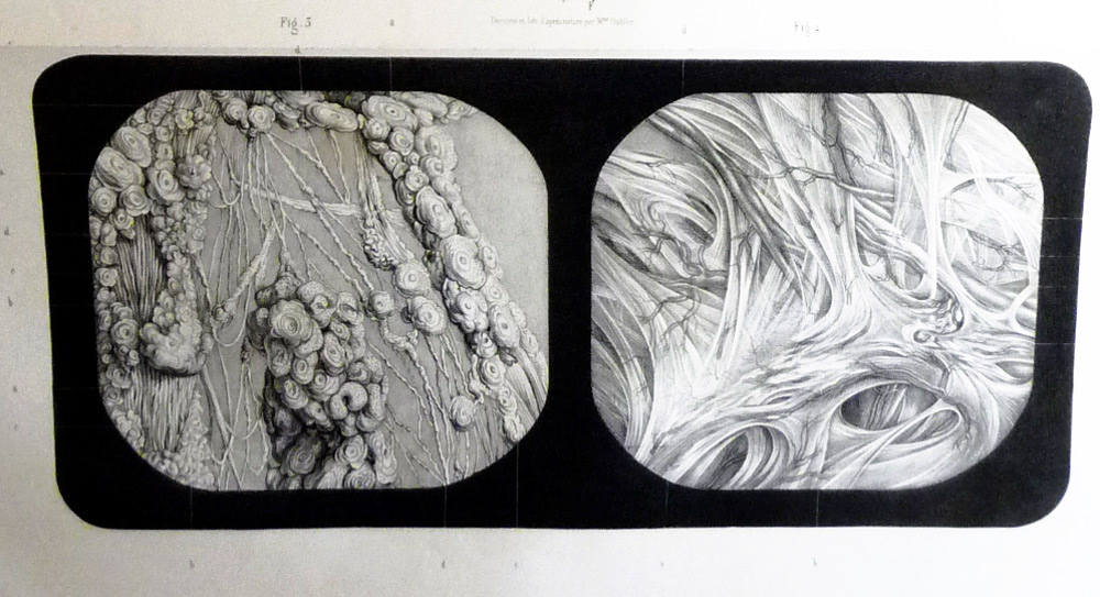 1844 Antique XL Solar Plexus Anatomy Lithograph Nervous System - Etsy