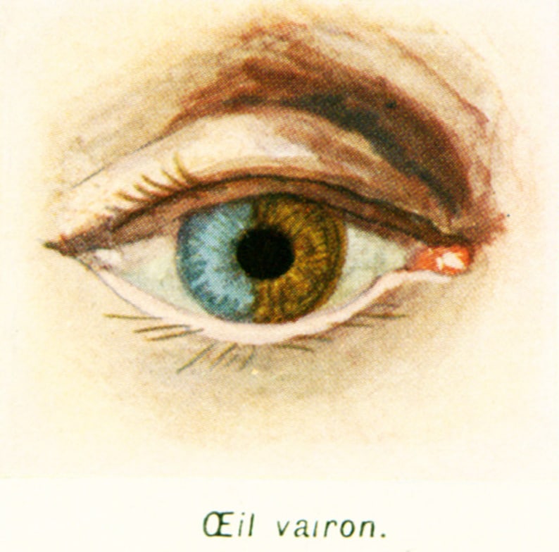 1912 Anatomie de l'oeil Oeil vairon maladies de l oeil - Etsy France