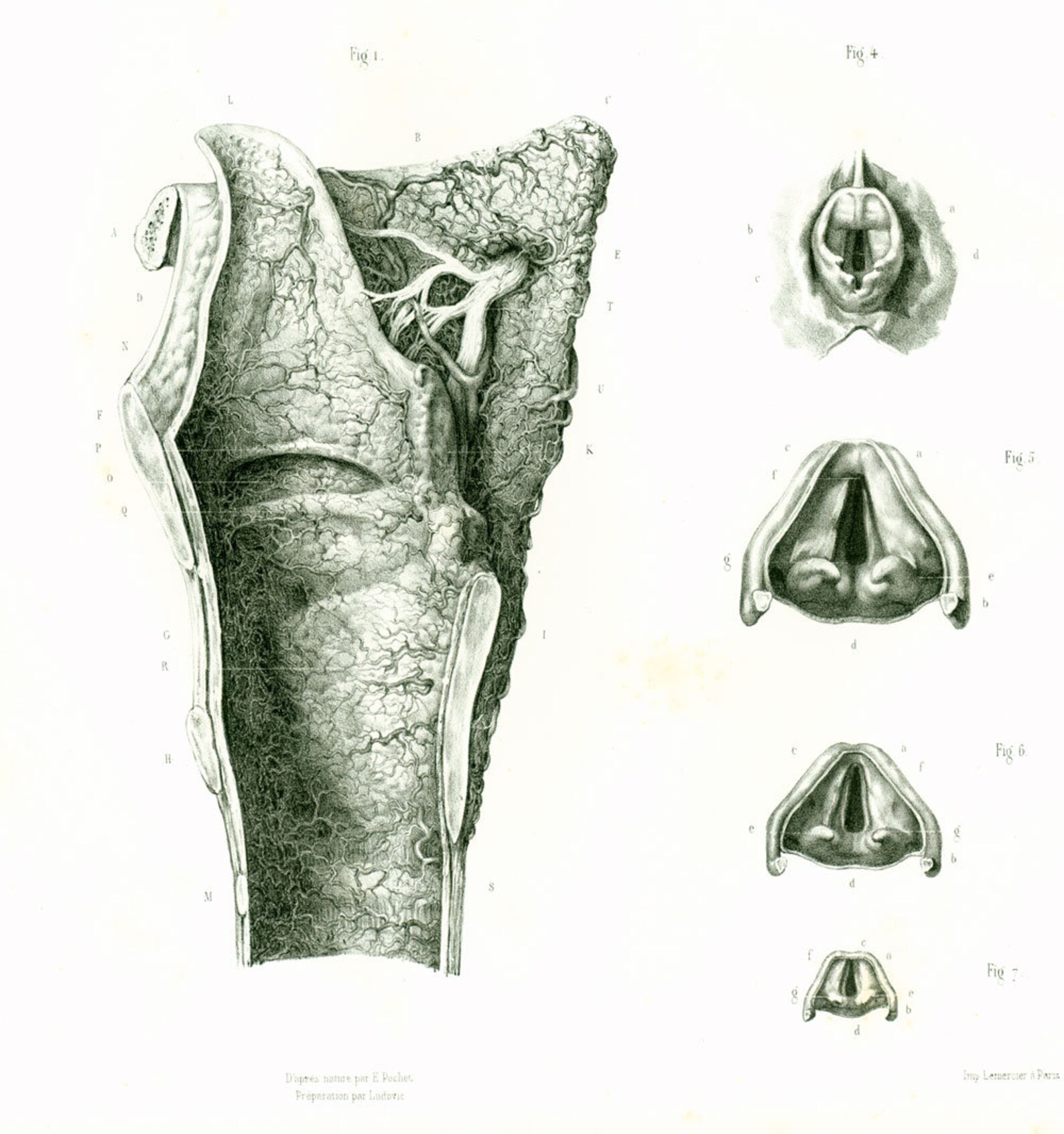 1836 Voice Box Human Larynx Print Olfactory System Nasal | Etsy