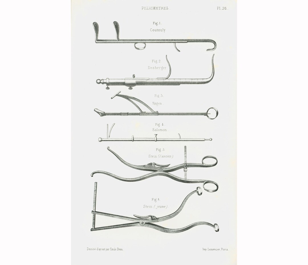 1865 Antique Obstetrical Tools Print, Pelvimeter, Midwife and ...
