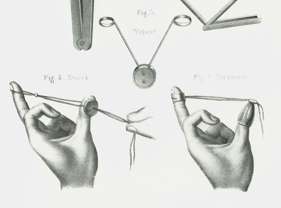 1865 Antique Obstetrical Tools Print Midwife and Obstetrics | Etsy