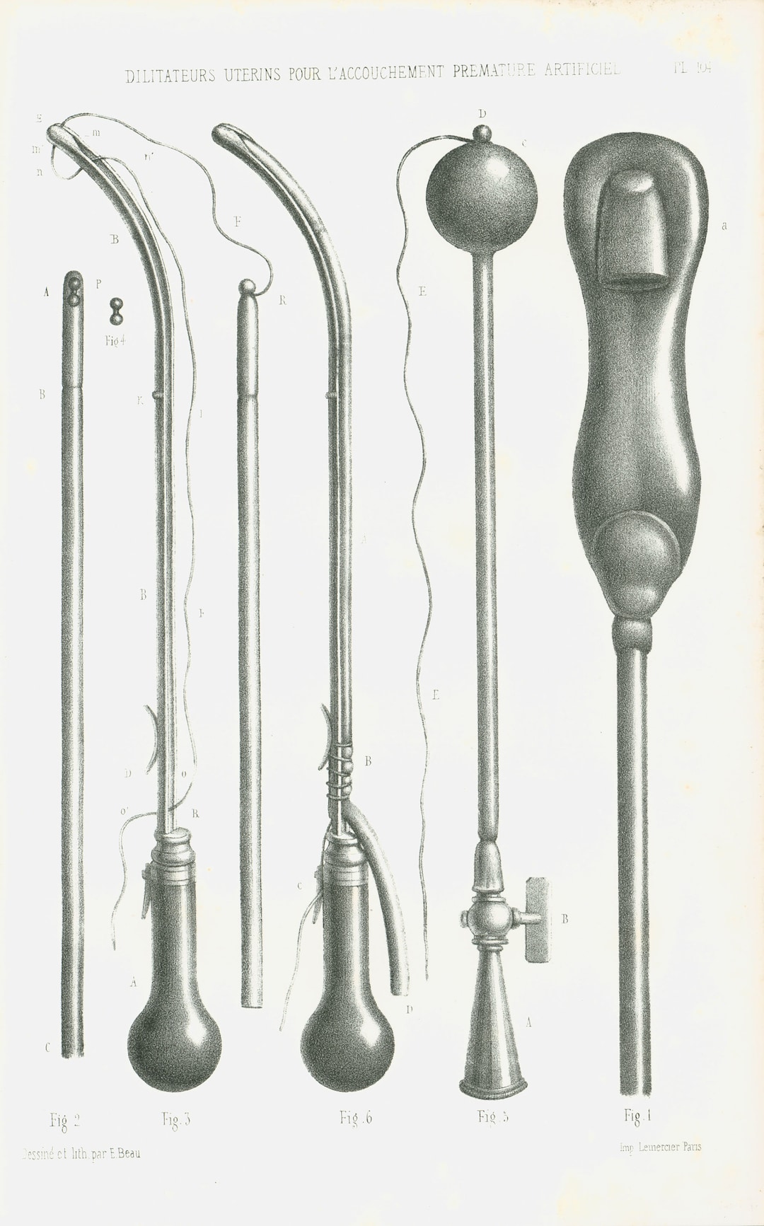 1865 Antique Obstetrical Tools Print, Pelvimeter, Midwife and ...