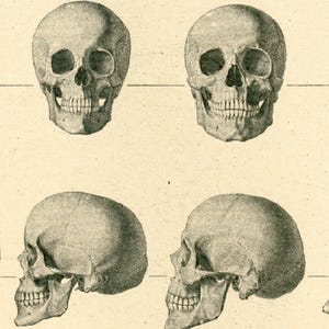 1908 Transformation of the Human Skull From Childhood to Old Age ...