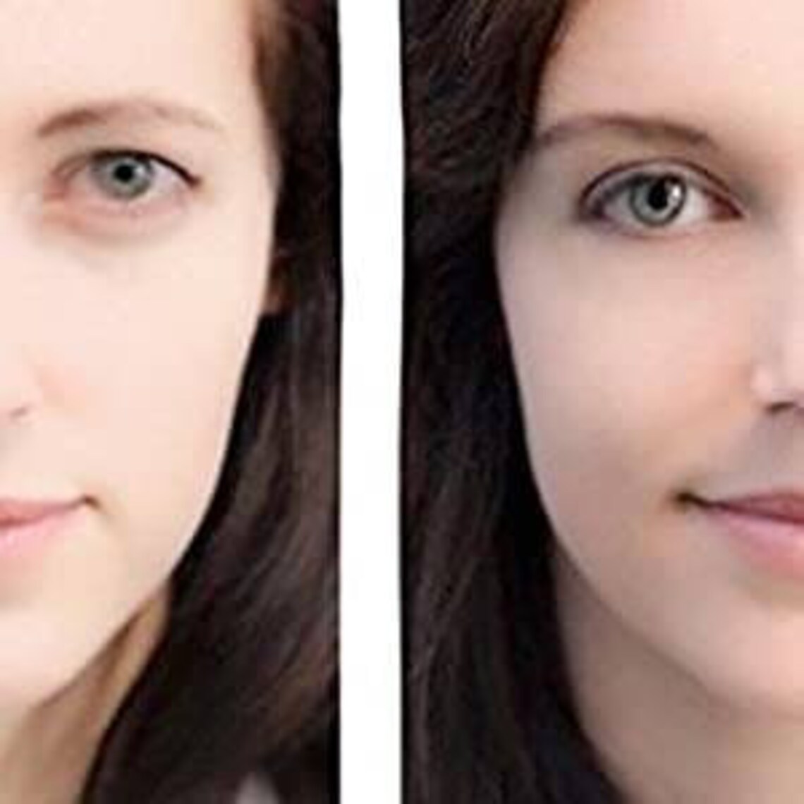 240 Transparent Eyelid Lifting Patches for Droopy Eyelids Lids - Etsy