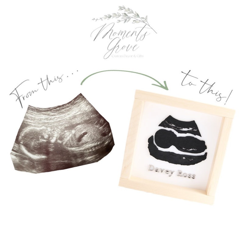 Custom 3D Ultrasound Wood Framed Sign Ultrasound Art Custom | Etsy