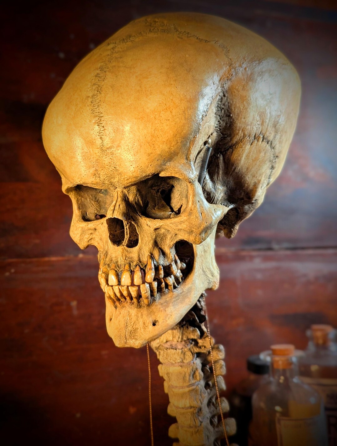 Large Cranium Hydrocephalic Human Skull Skeleton Sculpture Horror ...