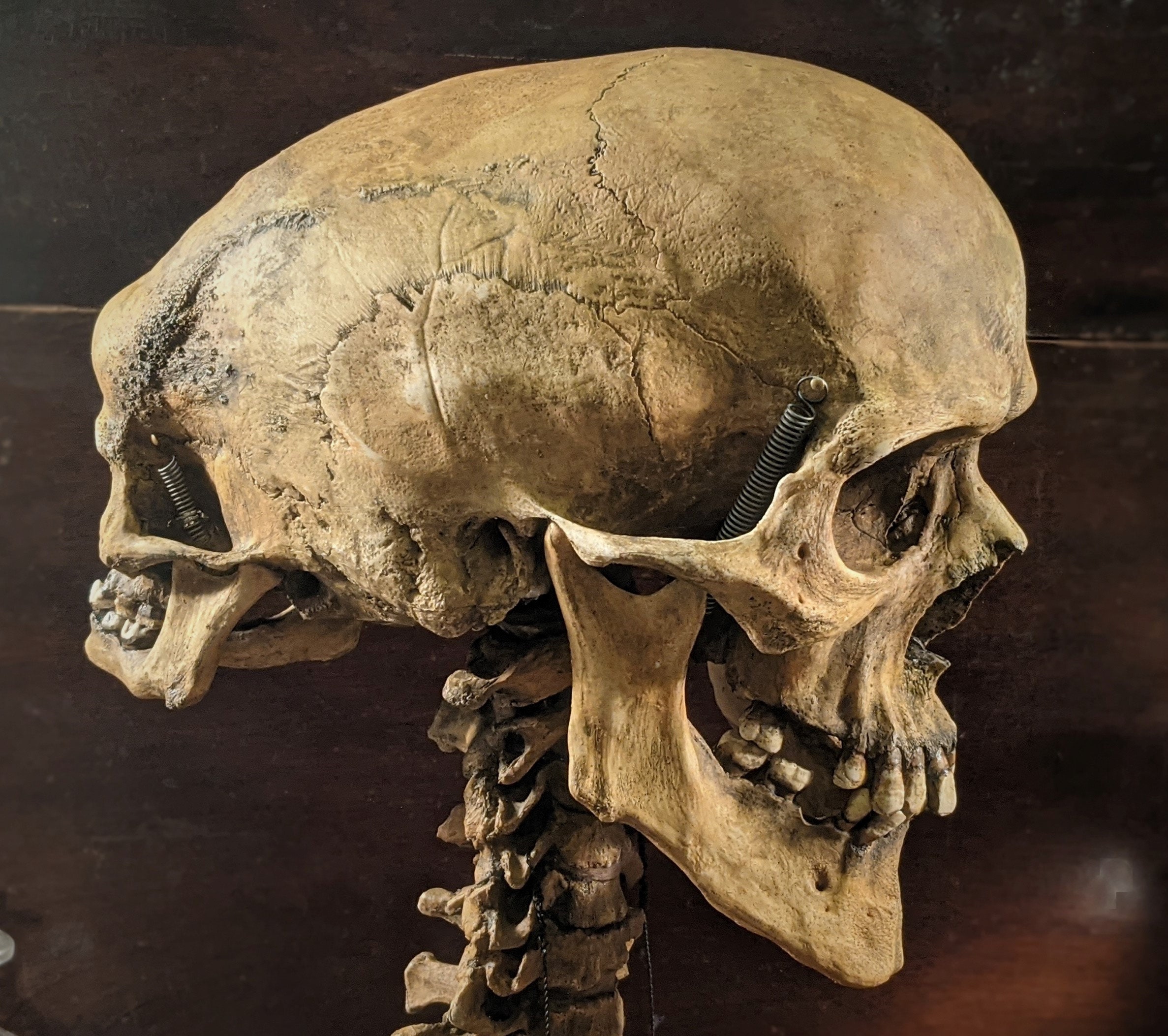 Edward Mordrake Movie