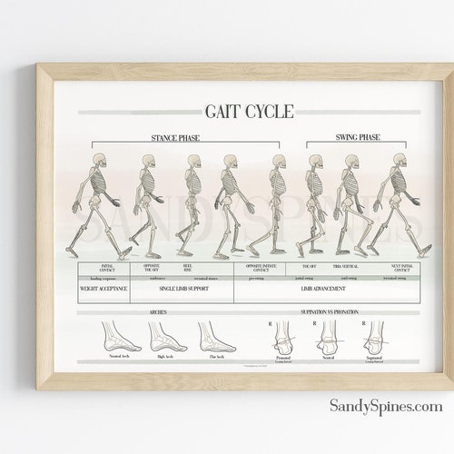 Gait Analysis Pattern Poster Sandyspines Art for - Etsy