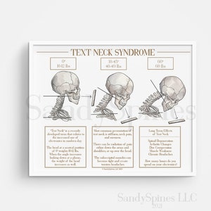 Text Neck Syndrome Poster SANDYSPINES Art for Medical - Etsy