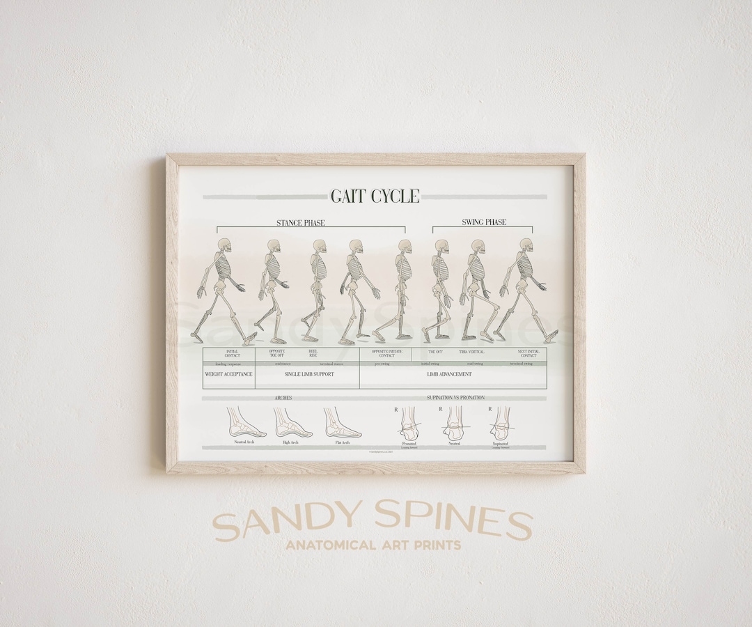 Gait Analysis Pattern Poster | Sandyspines | Art for Chiropractors ...