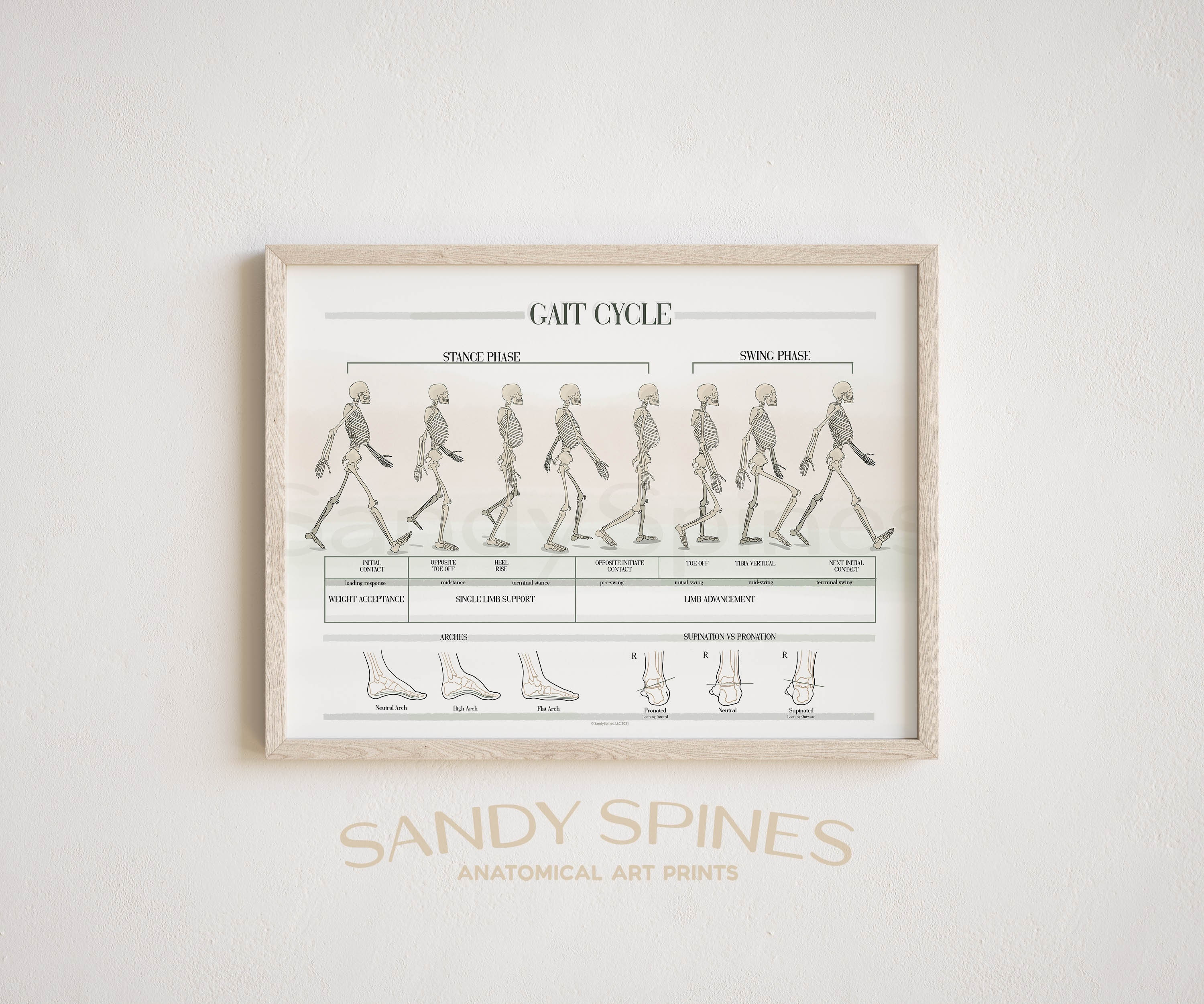 Gait Analysis Pattern Poster | Sandyspines | Art for Chiropractors ...