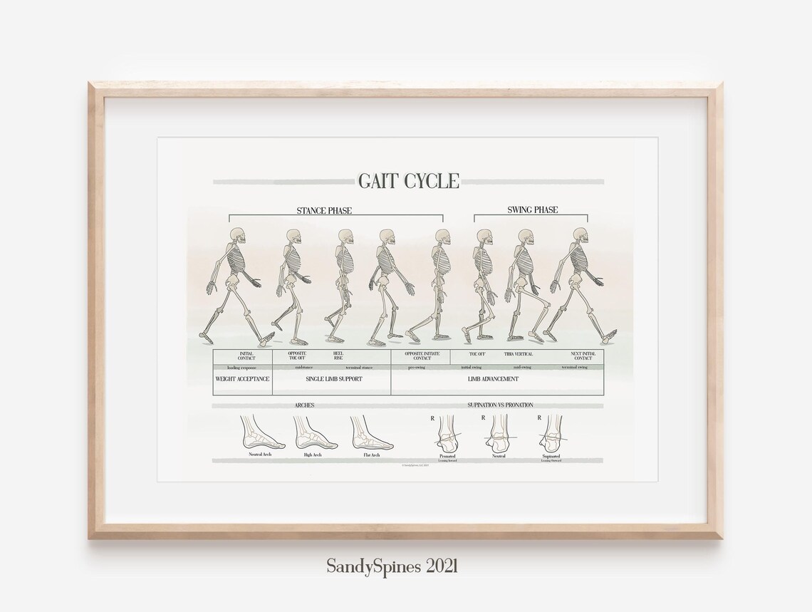 Gait Analysis Pattern Poster | Sandyspines | Art for Chiropractors ...