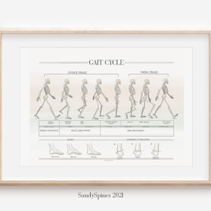 Gait Analysis Pattern Poster | Sandyspines | Art for Chiropractors ...