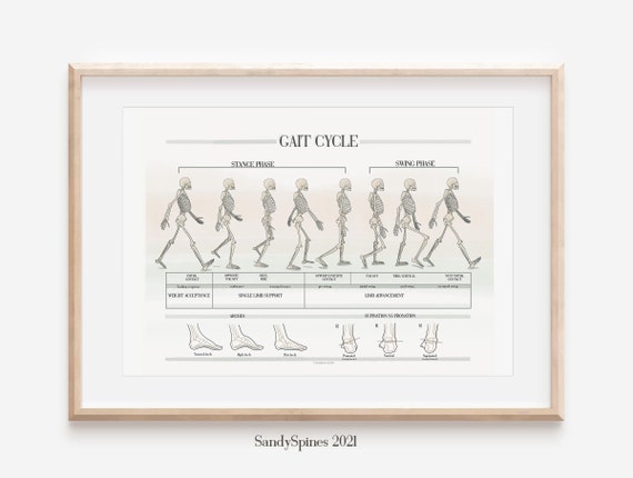 Gait Analysis Pattern Poster Sandyspines Art for | Etsy
