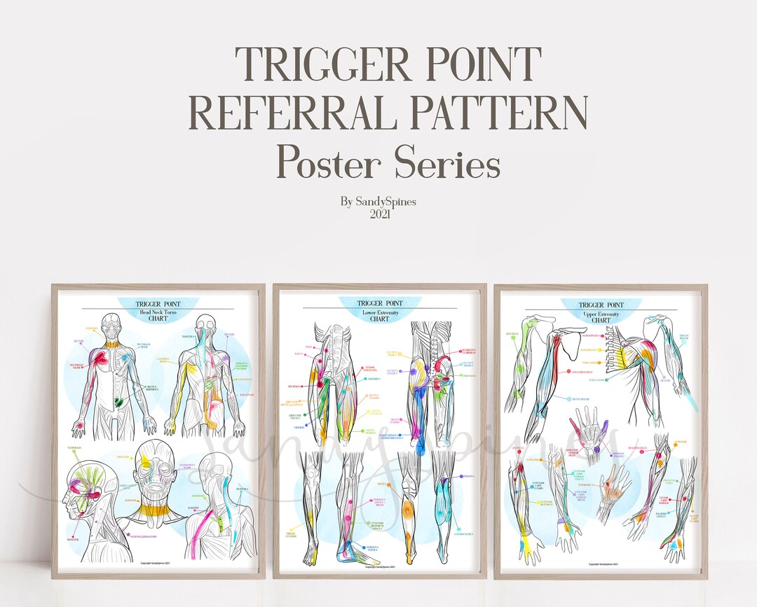 Muscle Trigger Point Charts Set of 3 Art for - Etsy