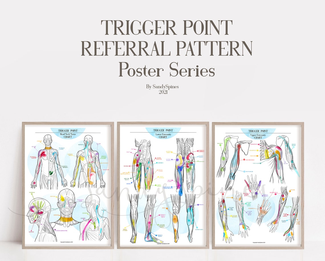Muscle Trigger Point Charts Set of 3 Art for - Etsy UK