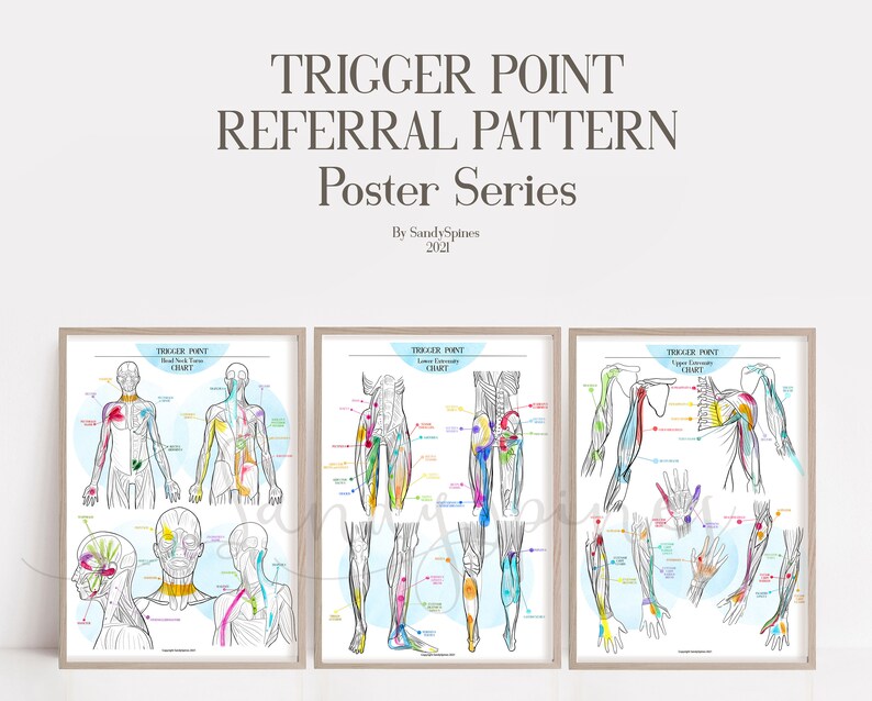 Muscle Trigger Point Charts Set of 3 Art for - Etsy UK