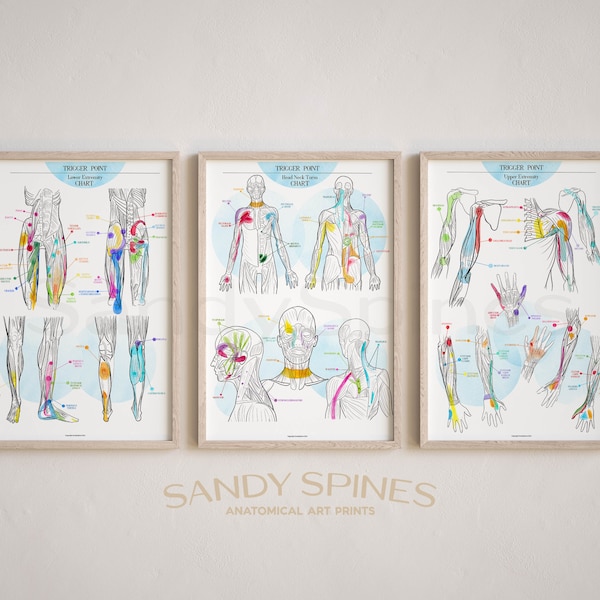 Muscle Trigger Point Chart - Etsy