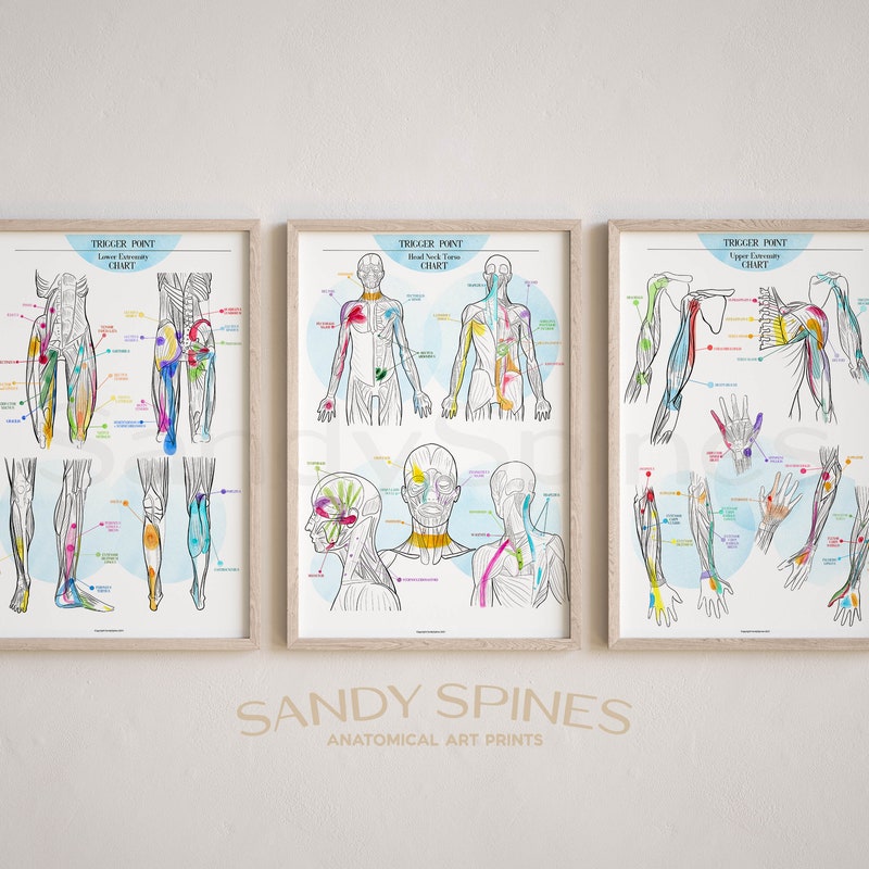 Muscle Trigger Point Chart - Etsy