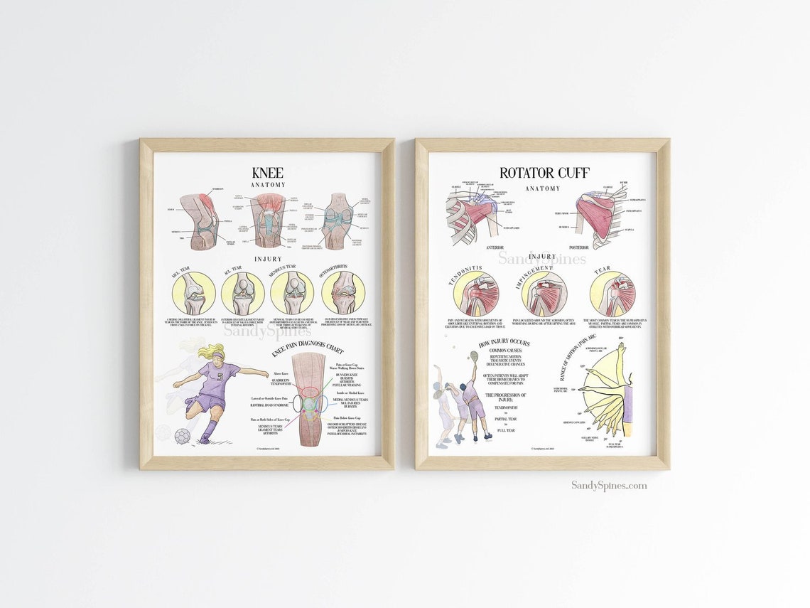 Rotator Cuff SITS Anatomy and Injury Poster Sandyspines - Etsy