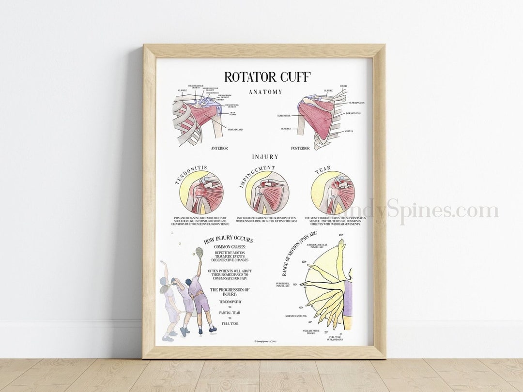 Rotator Cuff SITS Anatomy and Injury Poster Sandyspines - Etsy UK