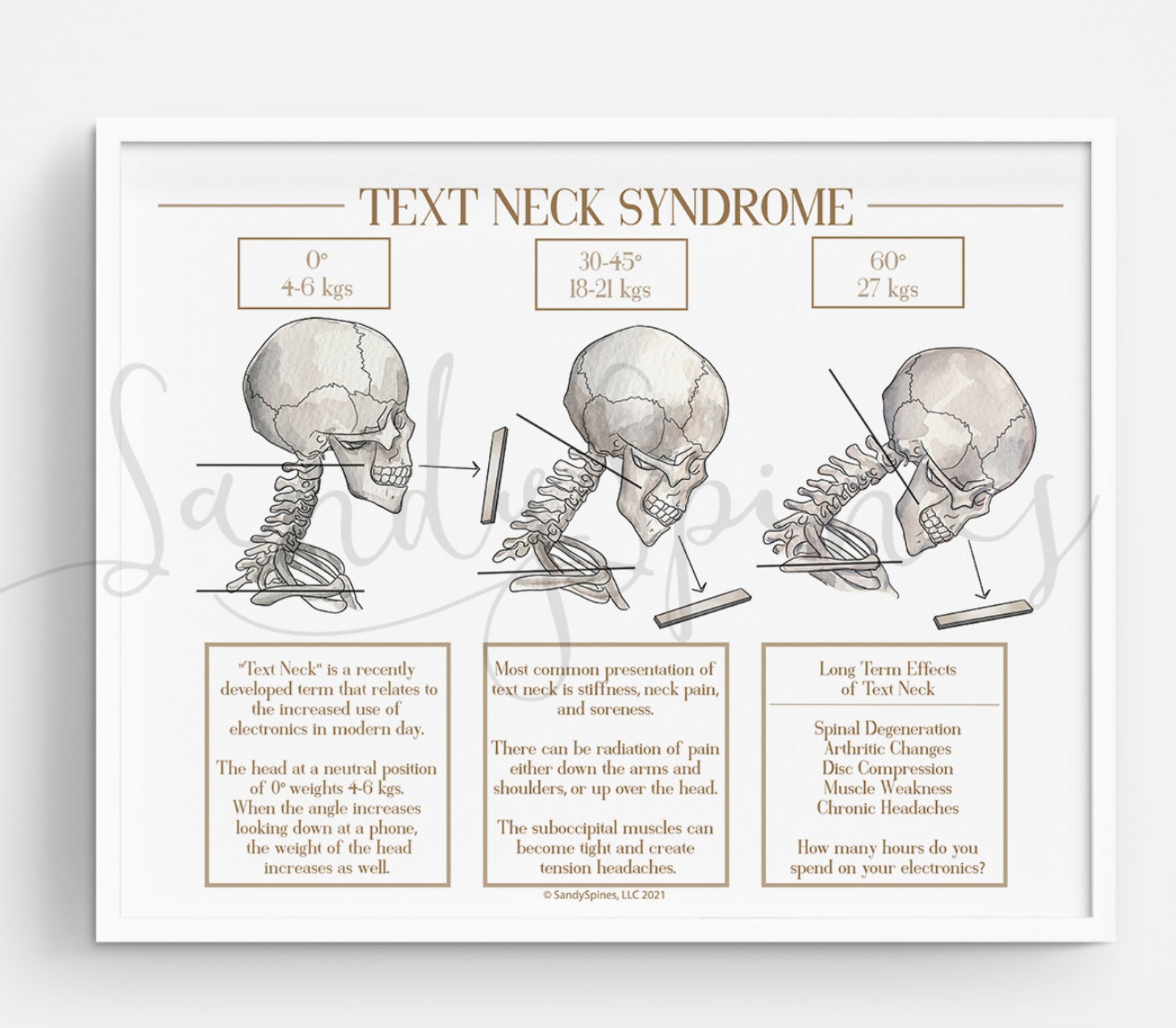 Text Neck Syndrome Poster SANDYSPINES Art for Medical - Etsy