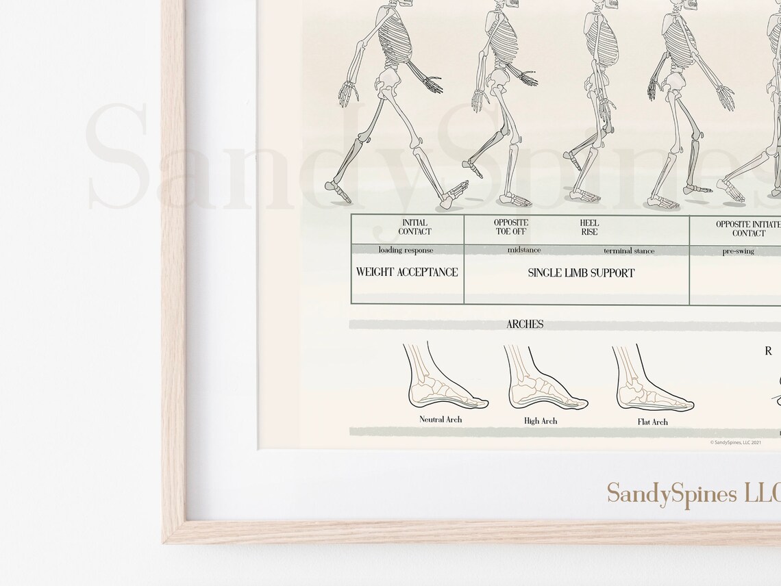 Gait Analysis Pattern Poster Sandyspines Art for - Etsy