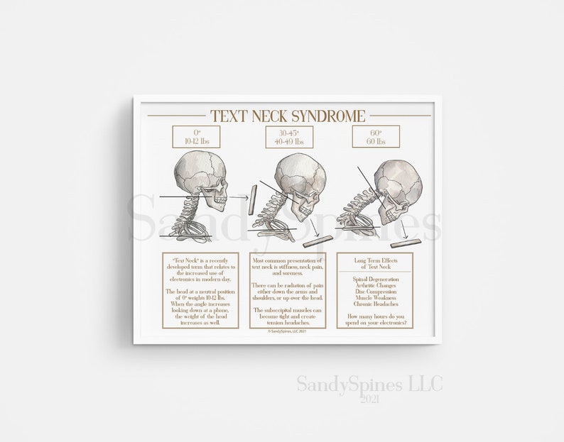 Text Neck Syndrome Poster SANDYSPINES Art for Medical - Etsy