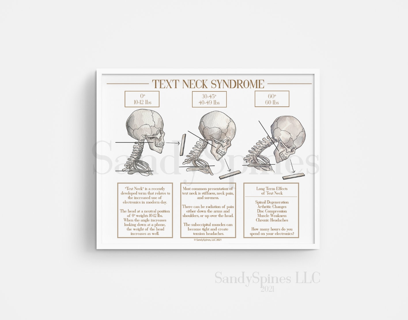 Text Neck Syndrome Poster SANDYSPINES Art for Medical - Etsy