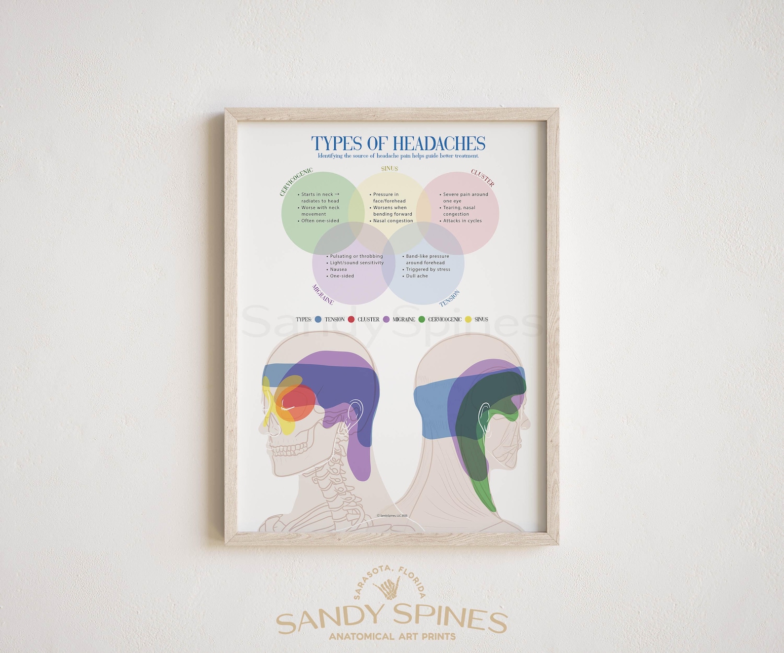 Type of Headaches Chart Poster | Chiropractic Art & Posters - Etsy